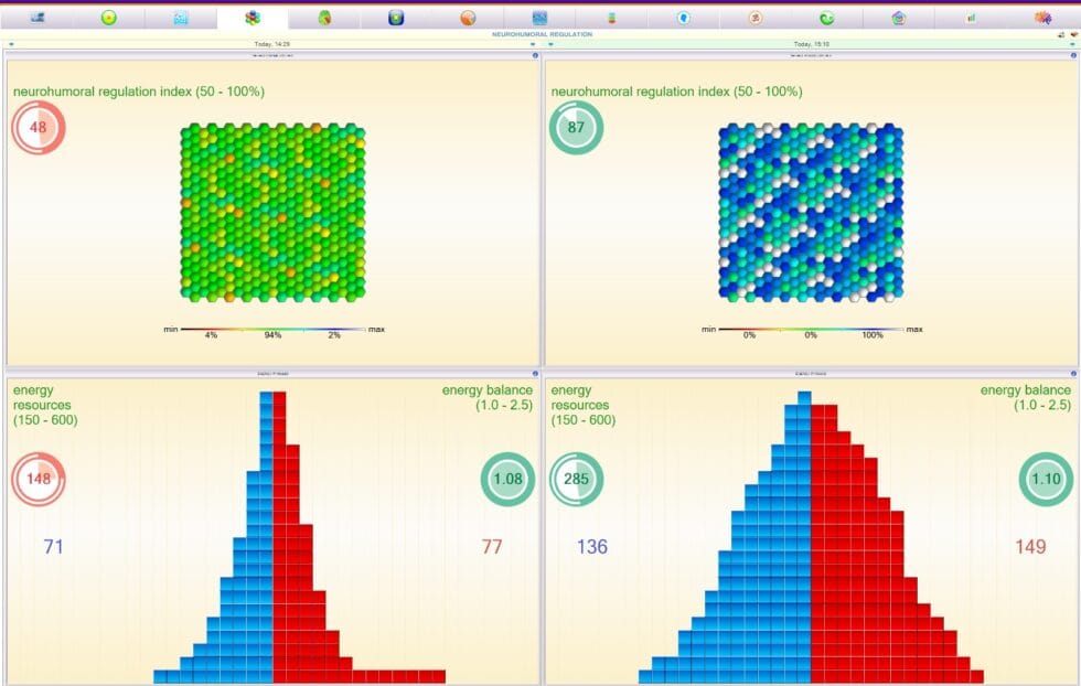 Younger You with Red Light Therapy - Spectra Red Light
